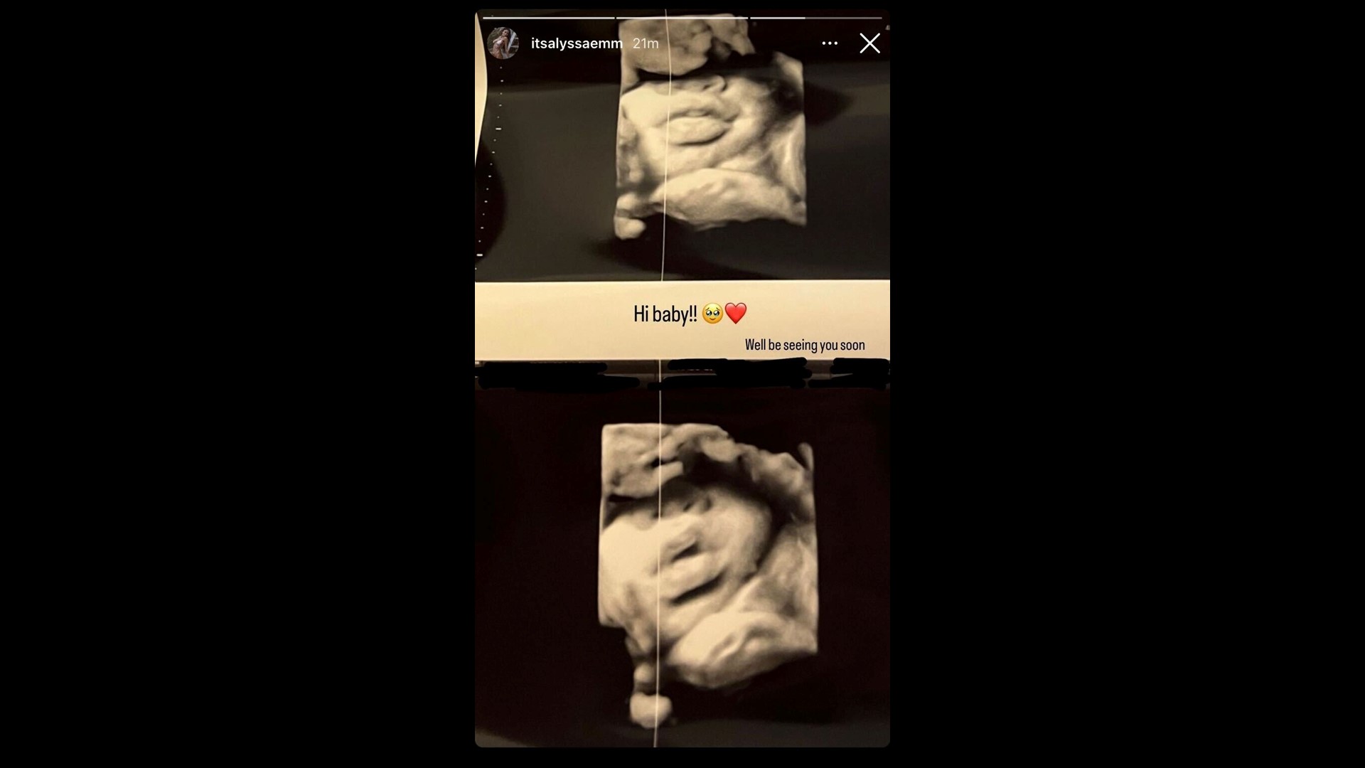 Alyssa Scott Posts Ultrasound Photos of Second Baby with Nick Cannon ...