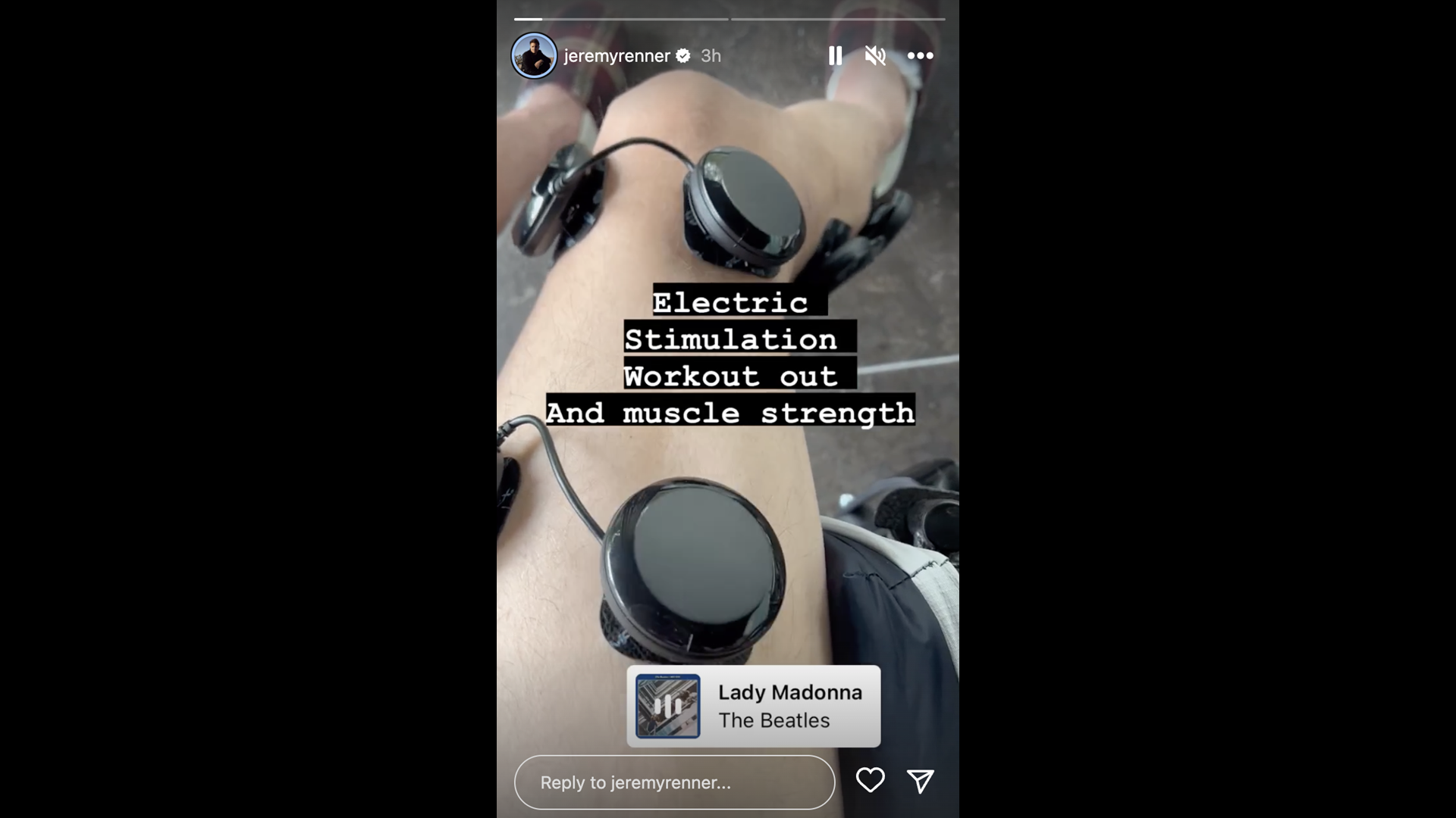 Jeremy Renner Gets Electric Stimulation on His Leg as He Continues ...