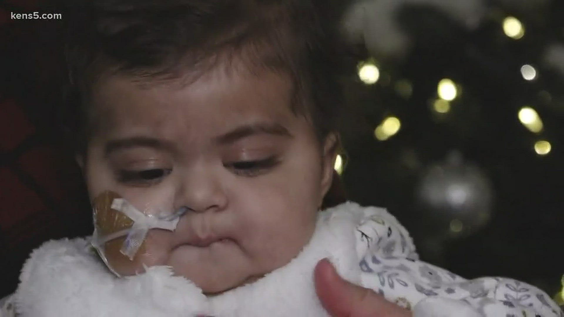 S.A. baby with rare disease shocks doctors, makes miraculous recovery ...