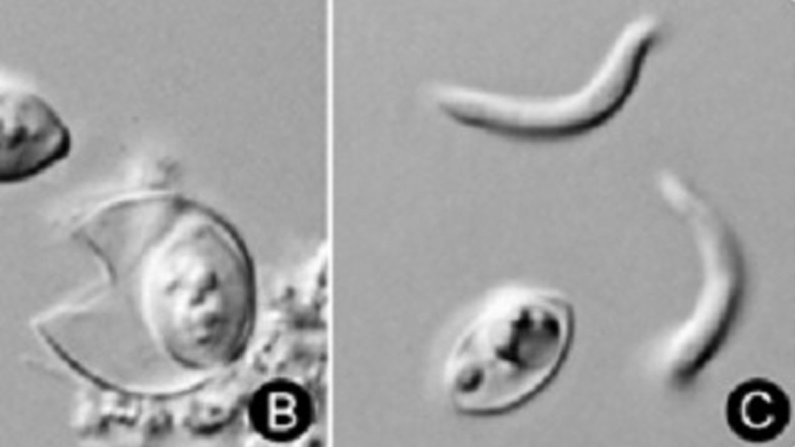 At least 82 cases of intestinal parasite illness cyclosporiasis ...
