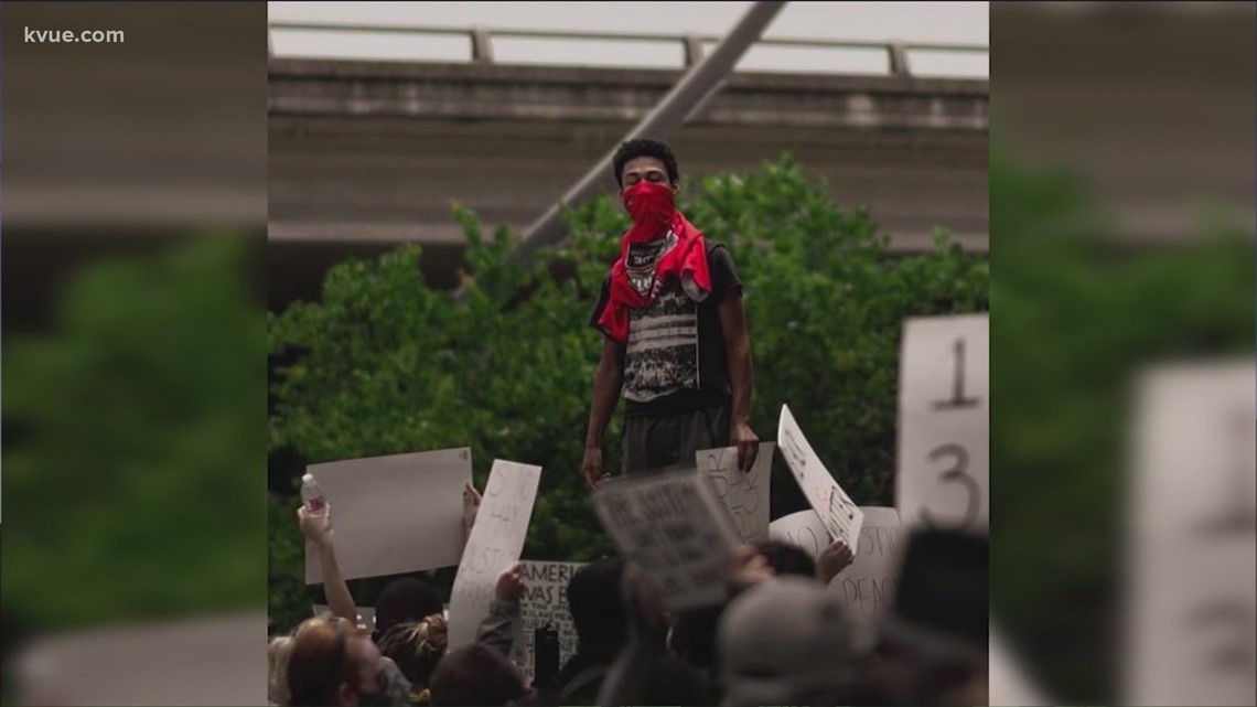Austin protester hit in the face by bean bag round speaks out | kvue.com