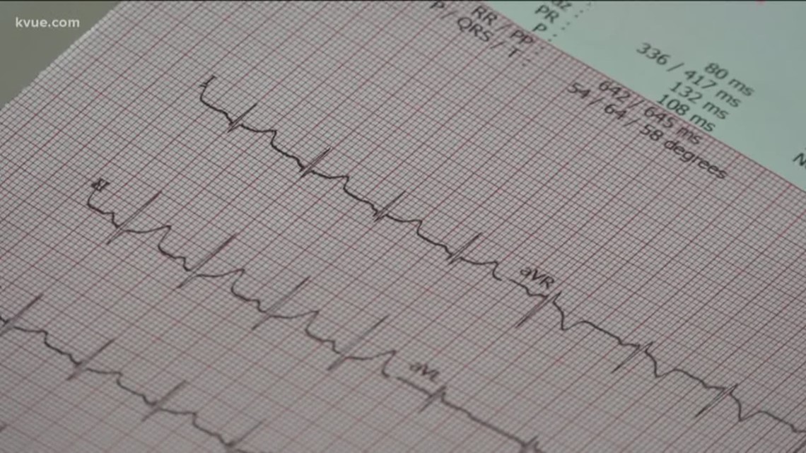 Student-athletes receive free heart screenings at Heart Hospital of ...