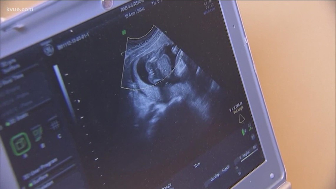 Lawsuits filed against San Antonio doctor who violated Texas abortion ...