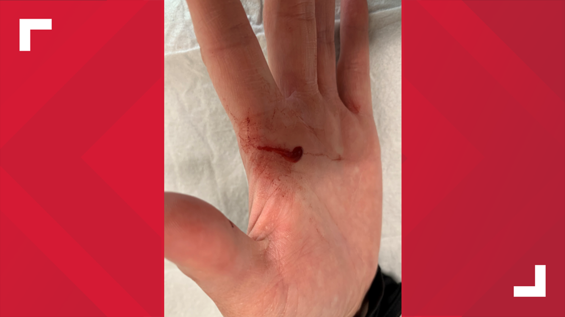 Walmart sued by woman after she says razor blade cut her | kvue.com