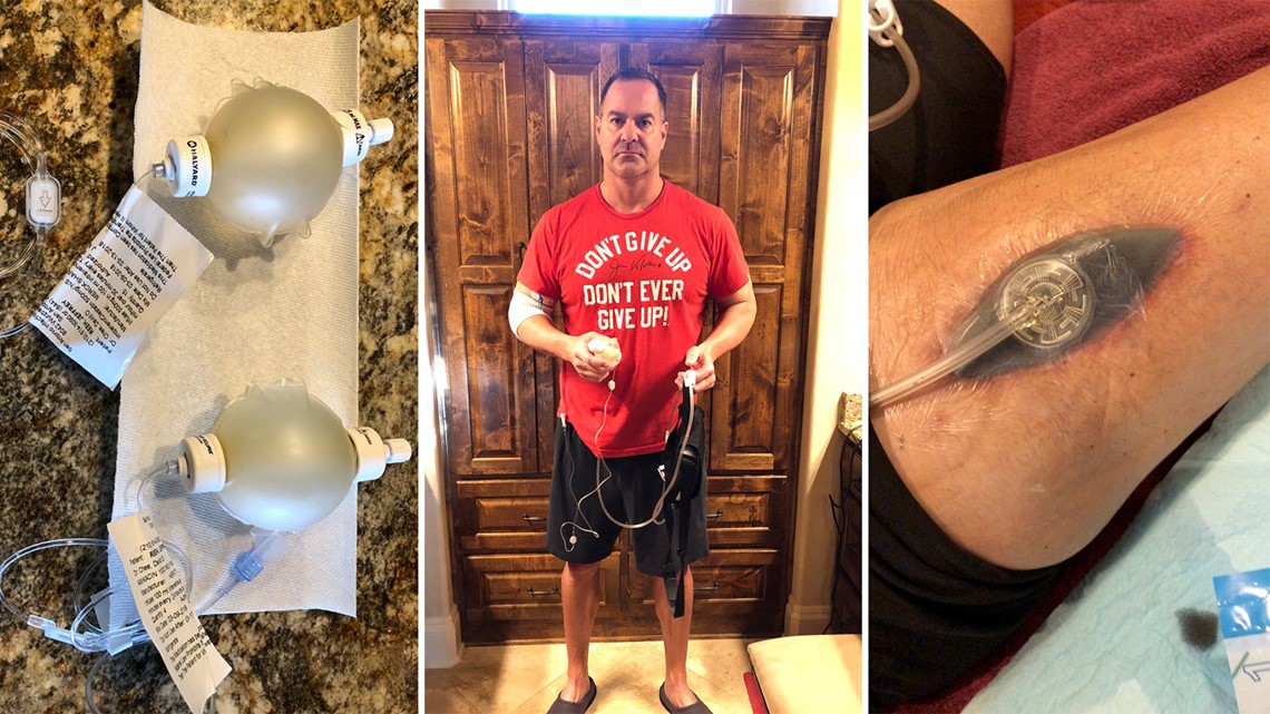 Compounded drugs: Man's story added to list of possible dangers | kvue.com