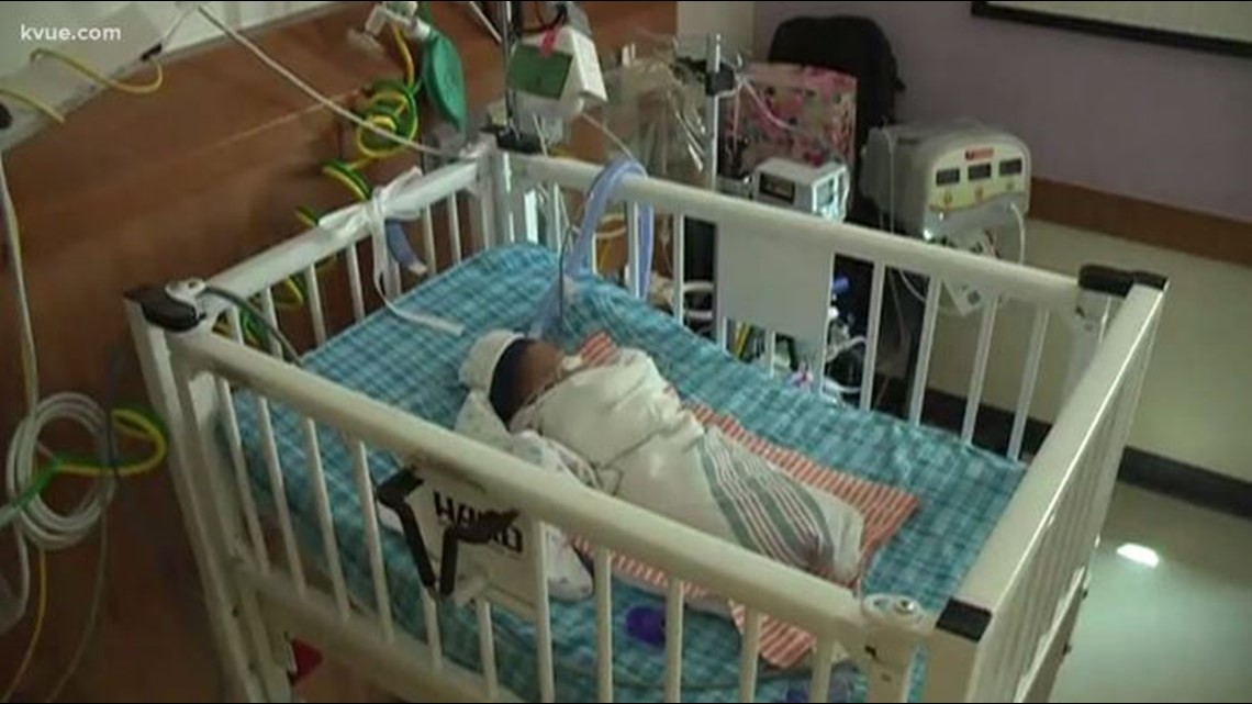 Dell Children’s camera systems connects NICU babies with families ...