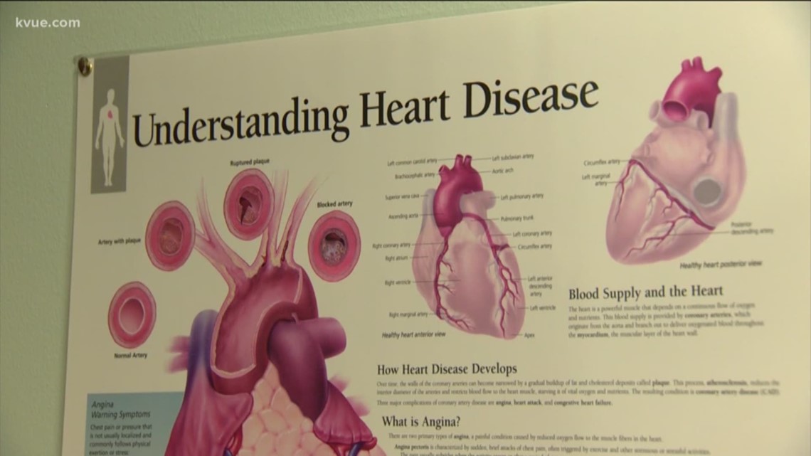 American Heart Month: Cardiologist tips for tackling high cholesterol ...
