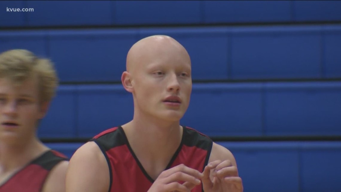 'It's almost like a blessing that it happened' | Judge a book by its ...