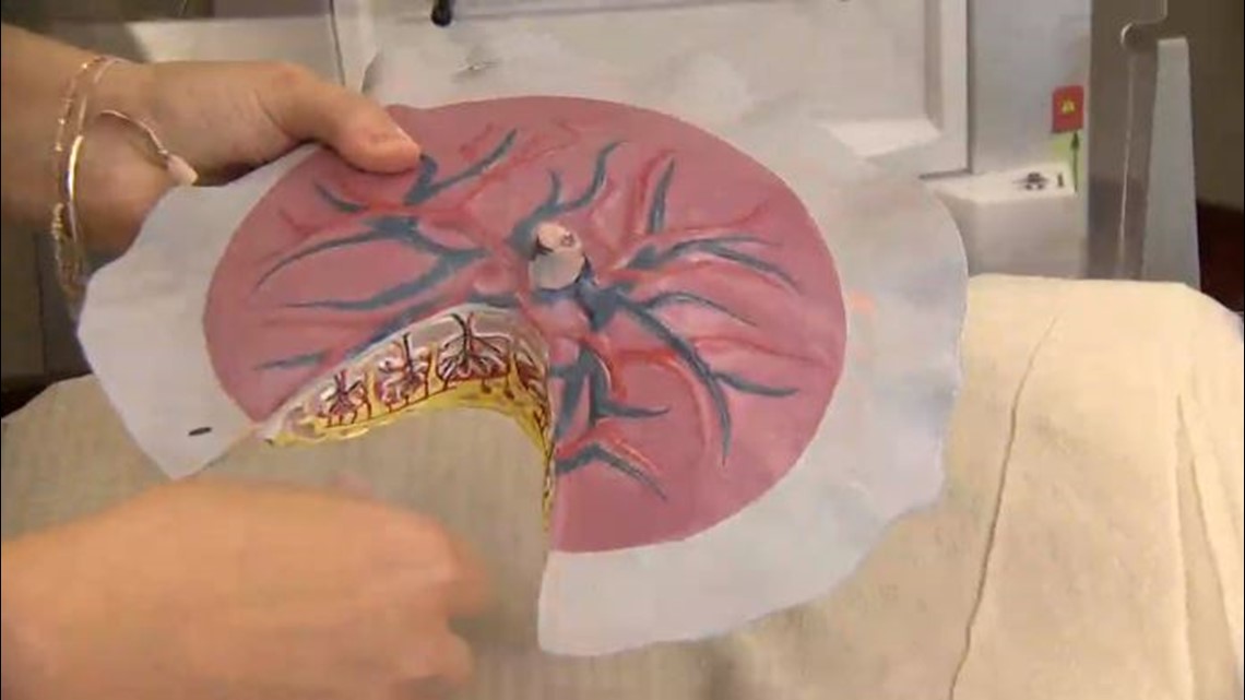 Central Texas mothers can donate placenta to help other patients | kvue.com