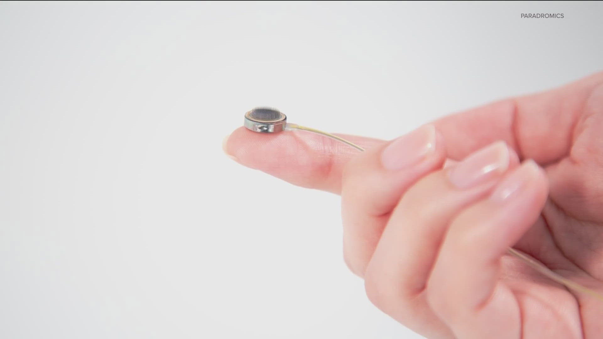 Paradromics announces first in-human implantation of brain-computer ...
