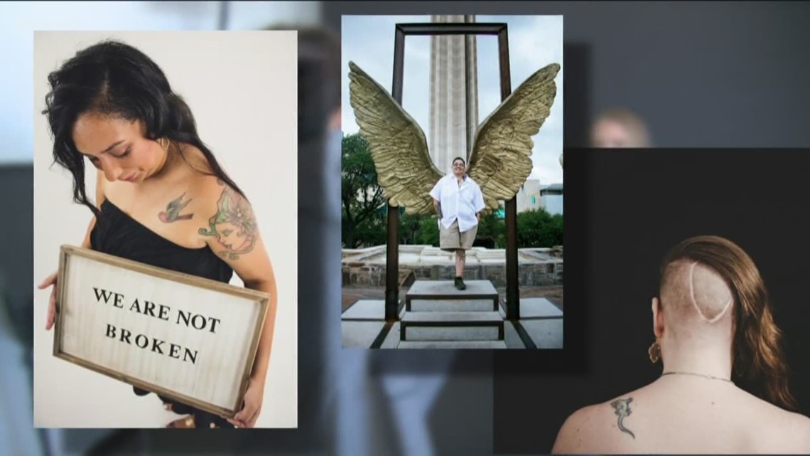 Pay it Forward: Woman photographs women with scars | kvue.com