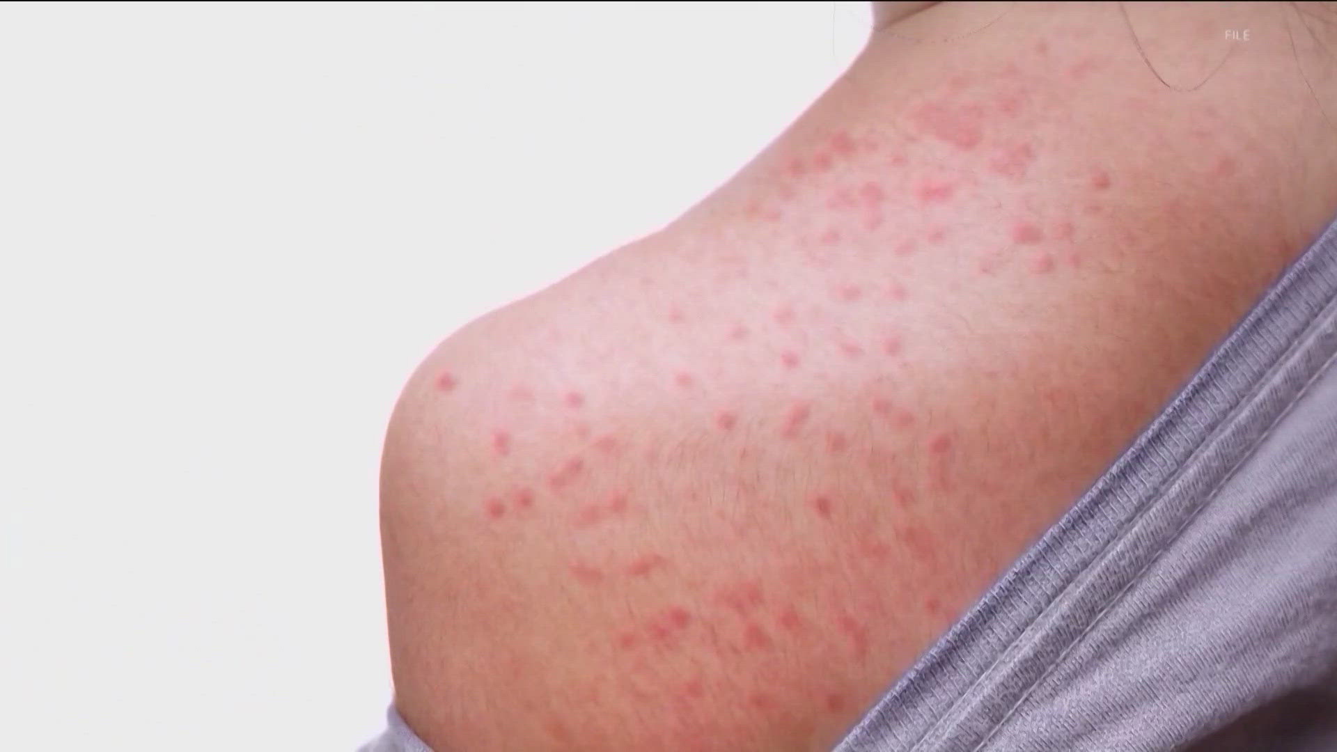 Central Texas MMR vaccination rates amid Texas measles outbreak | kvue.com