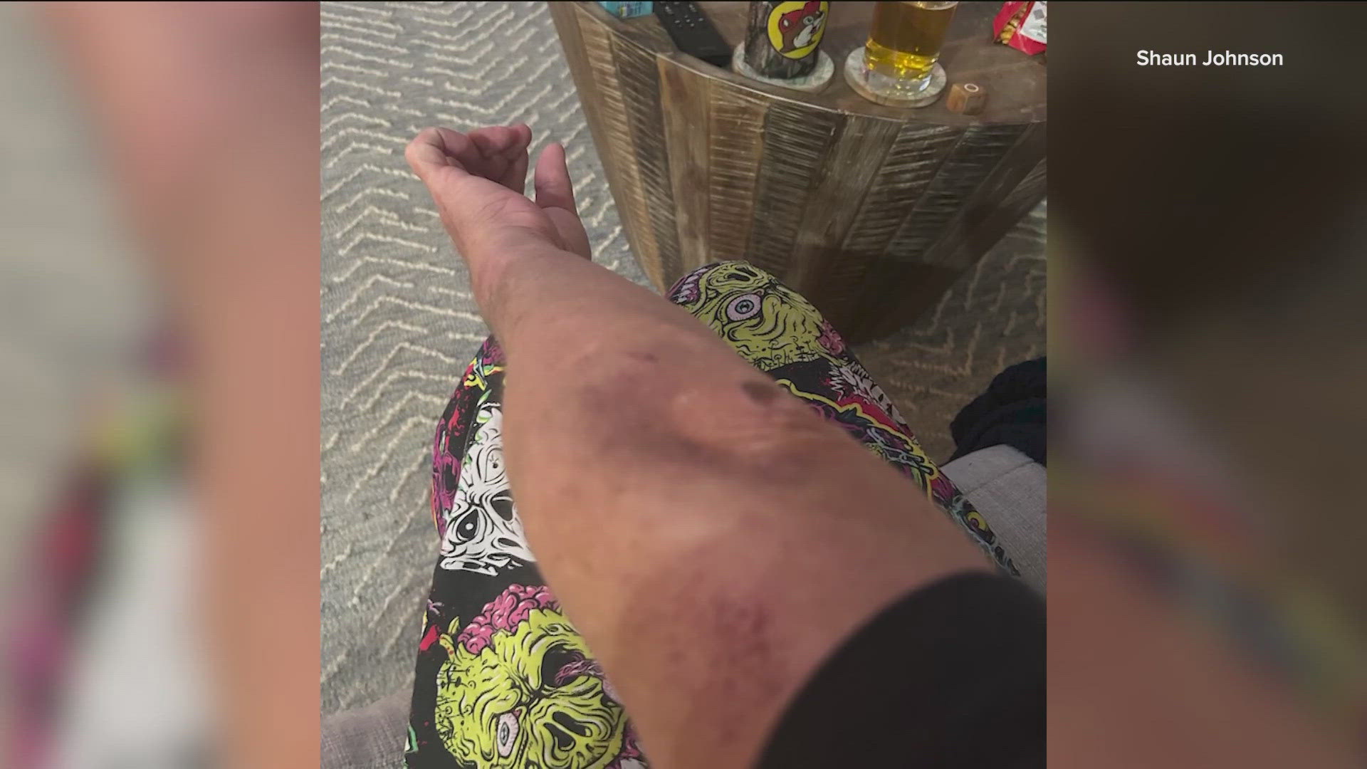 Victim speaks out on former Austin Police officer's alleged assault ...