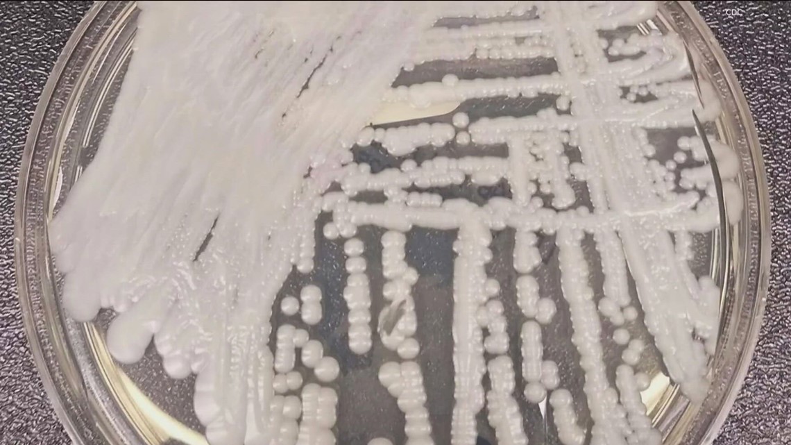 Texas healthcare officials tackle deadly fungal infection | kvue.com