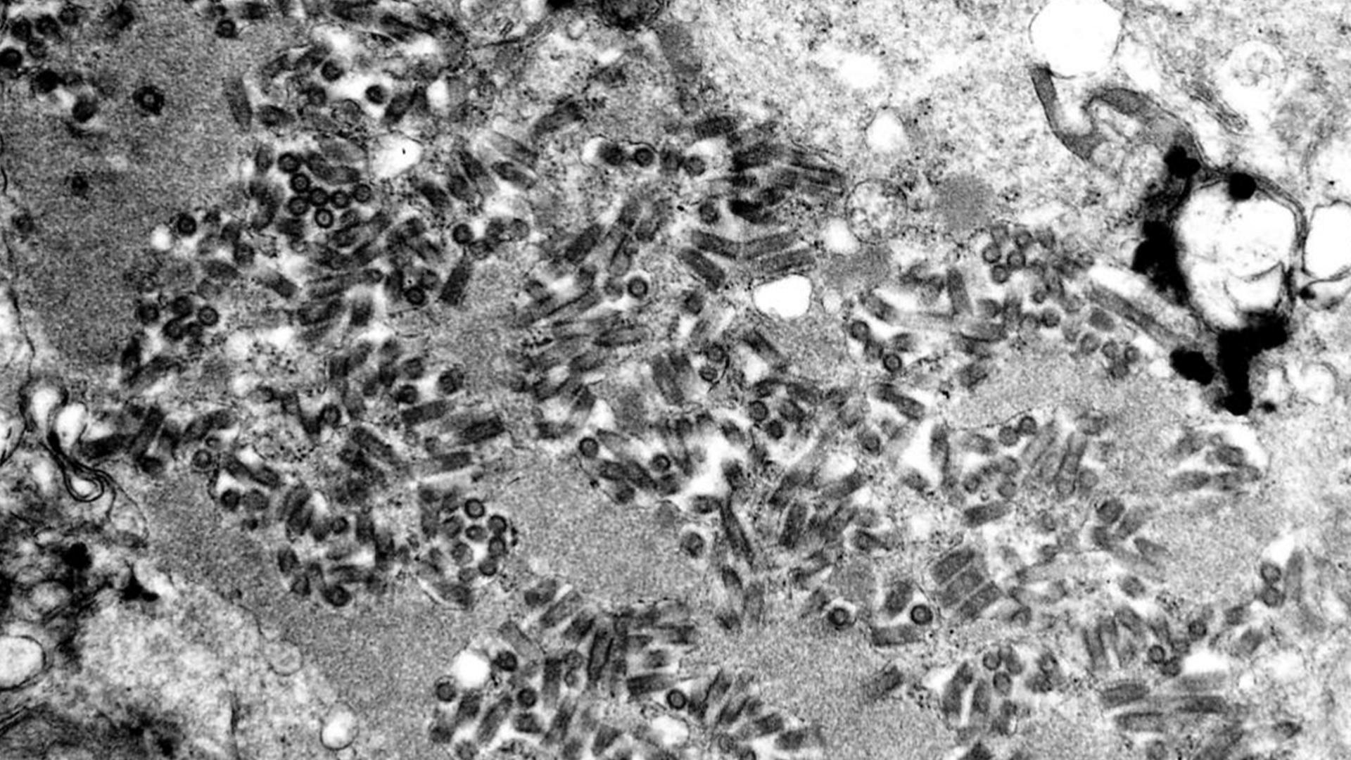 Fox found in Central Texas tests positive for rabies | kvue.com