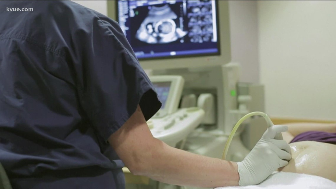 Texas' 'Heartbeat Act' is now law. How would lawsuits work? | kvue.com