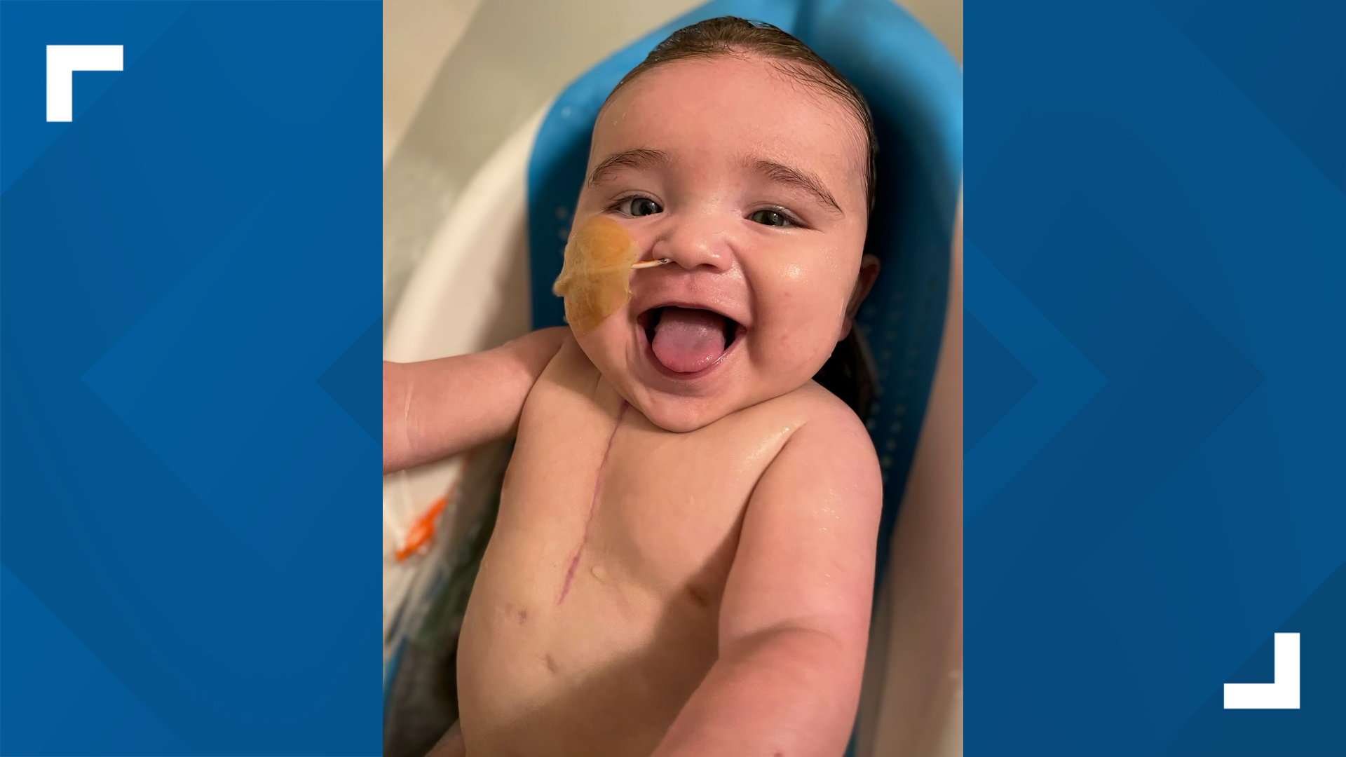 Austin baby born with rare heart defect turns 1, parents and doctor ...