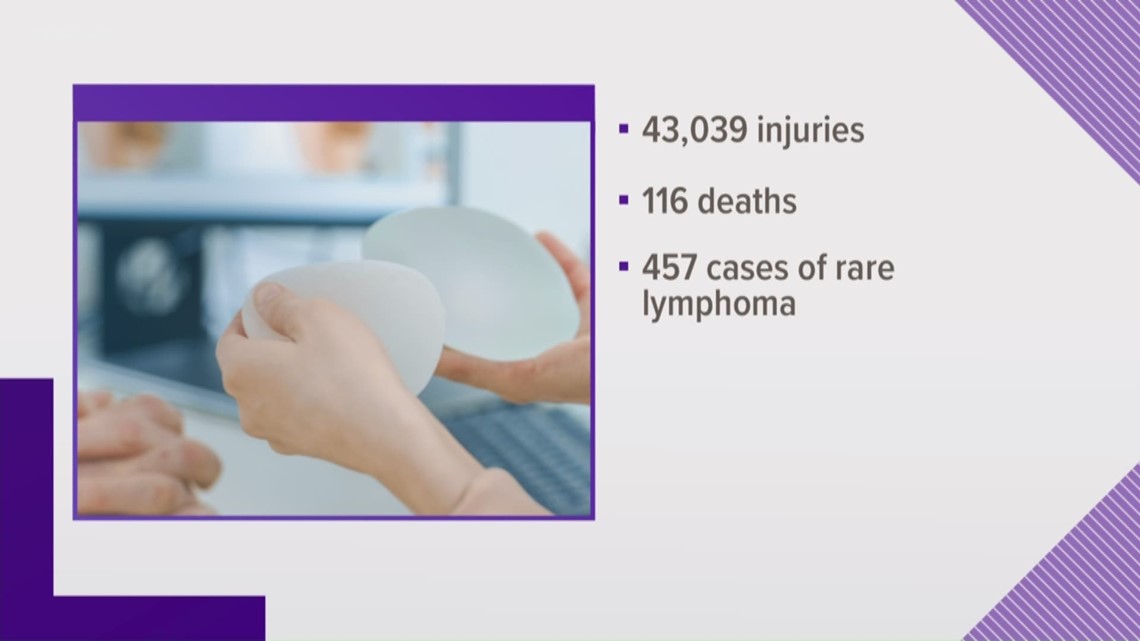 Breast implant safety hearing latest in FDA medical device ...