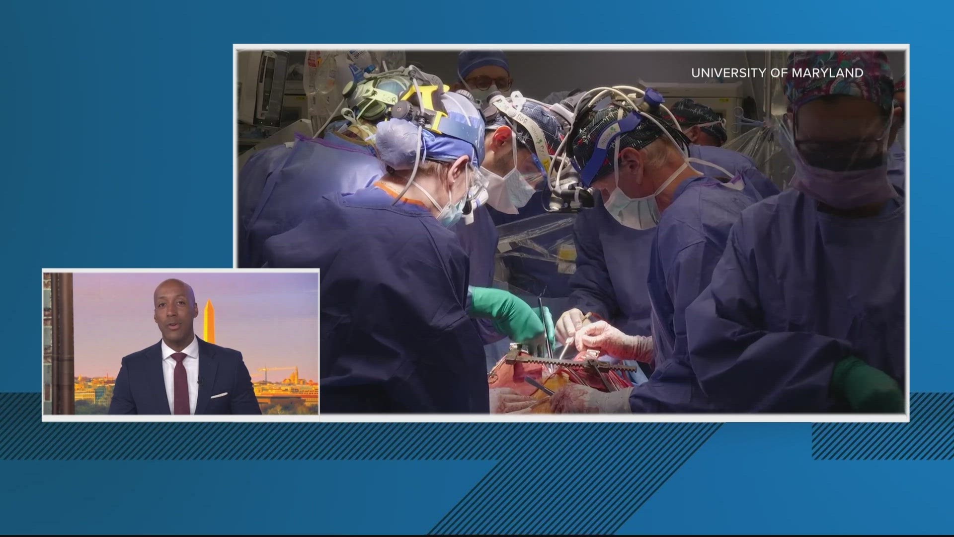 Surgeons perform second pig heart transplant | kvue.com